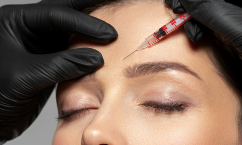 Neuromodulators – Esthetics Wellness International